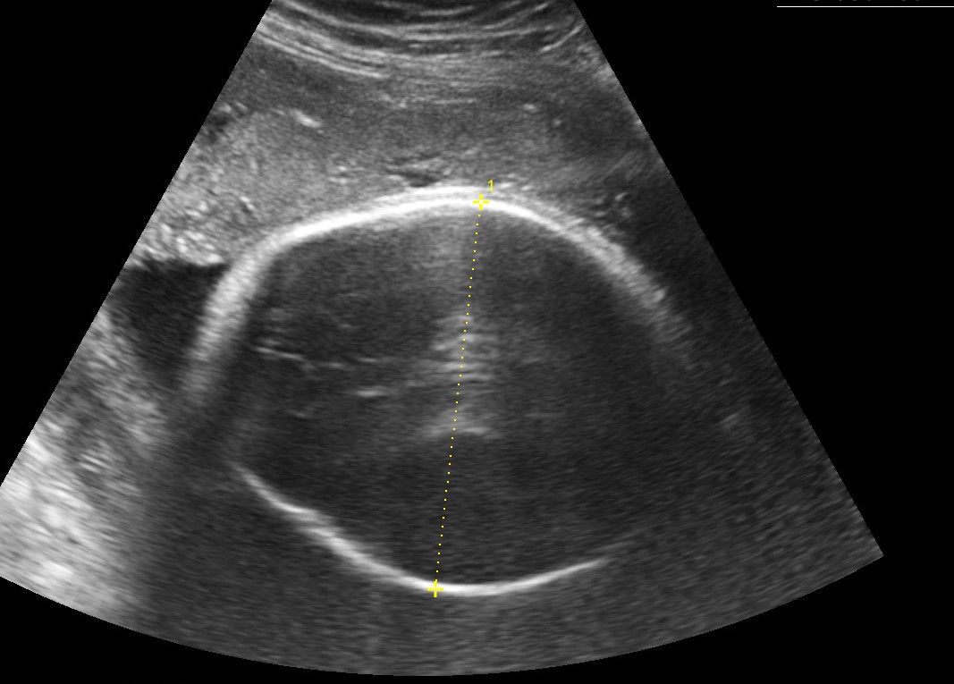 Different Types of Ultrasounds: A Comprehensive Guide - Mascot ...